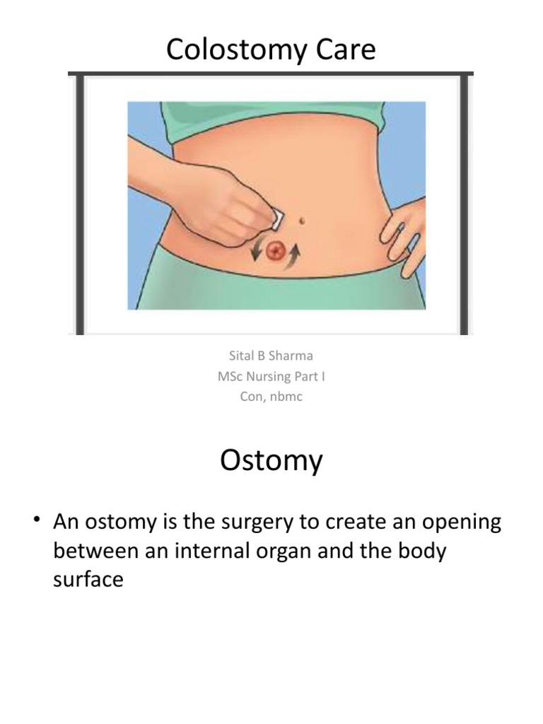 Colostomy Care: Sital B Sharma MSC Nursing Part I Con, NBMC | PDF ...