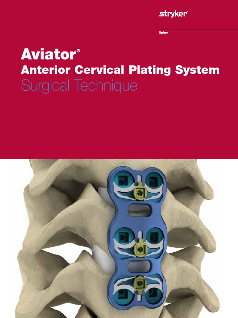 Aviator Cervical Plate Stryker (ID 857) | PDF | Drill | Screw