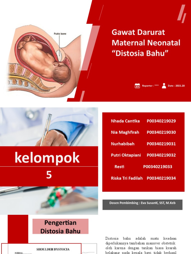 Distosia Bahu k5 Fix | PDF | Kajian Bahasa Asing | Kesehatan Holistik