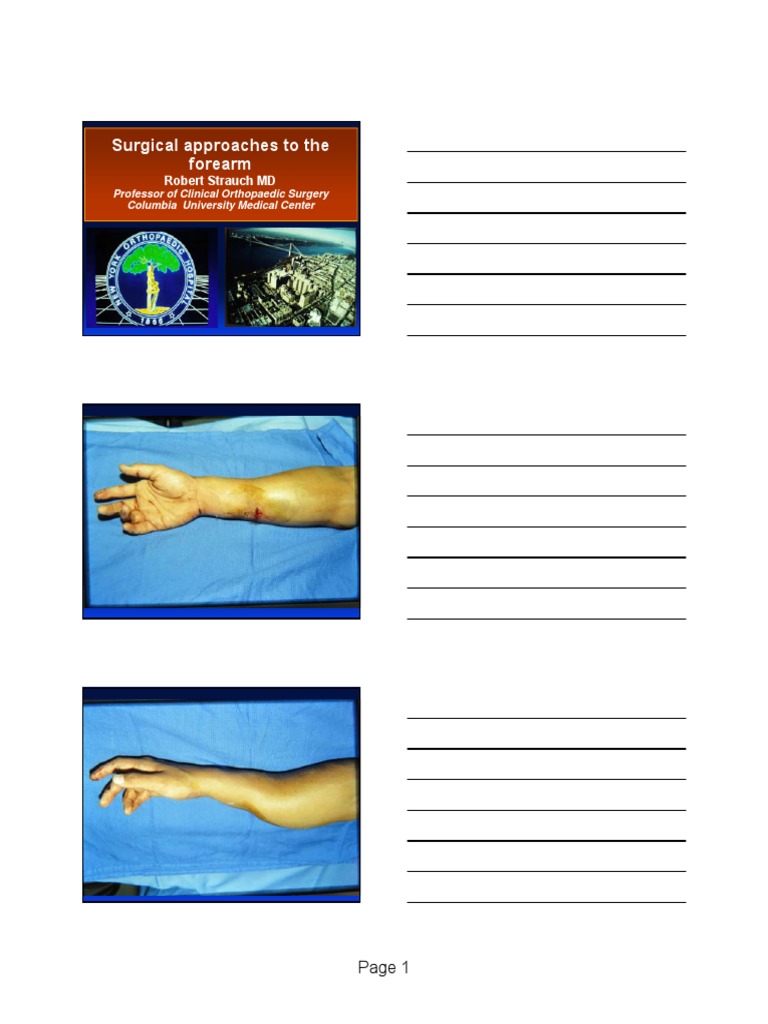 Surgical Approaches To The Forearm: Robert Strauch MD | PDF ...