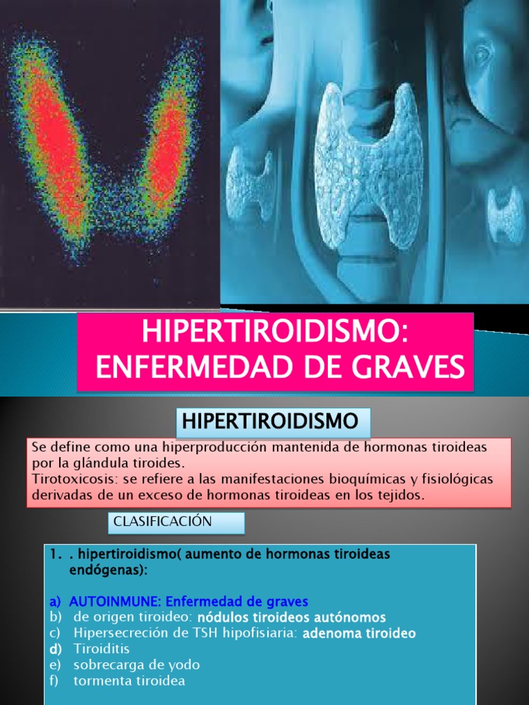 12-. Enfermedad de Graves Basedow | PDF | Hipertiroidismo | Tiroides