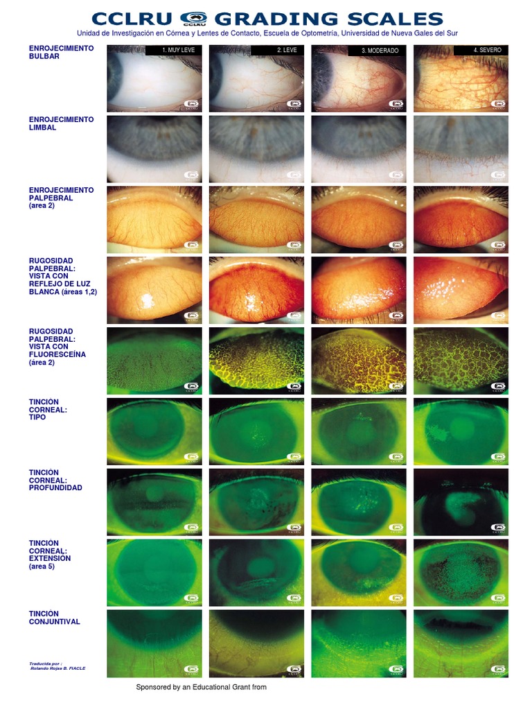 Escala Cclru Traduccion | PDF | Inflamación | Córnea