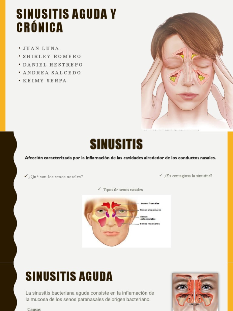 Sinusitis Aguda y Crónica: Causas y Tratamiento | PDF | Epidemiología ...