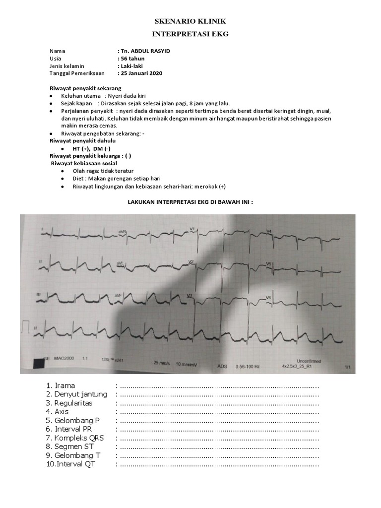 19 Skenario Klinis - Interpretasi EKG - MAHASISWA | PDF