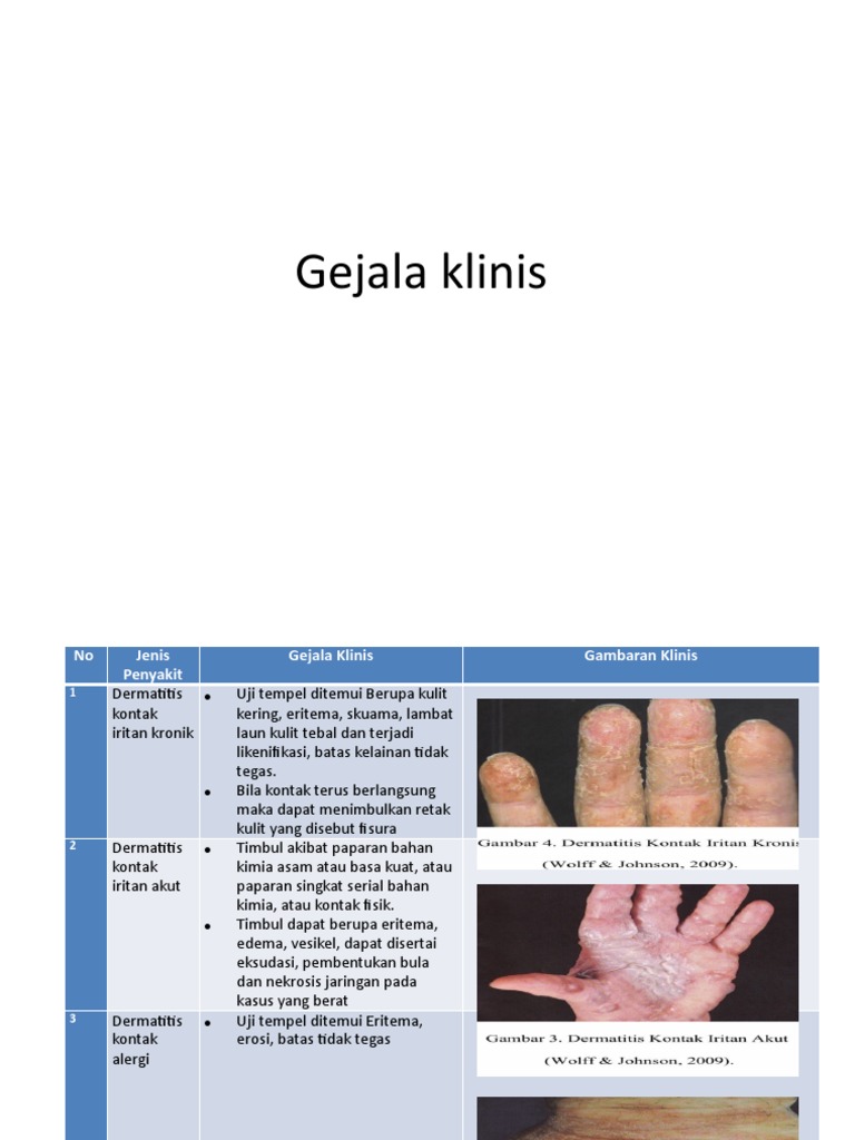 Gejala Klinis DKI DAN DKA | PDF