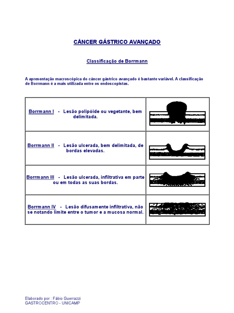 Classificação de Borrmann | PDF | Neoplasmas | Doenças e distúrbios