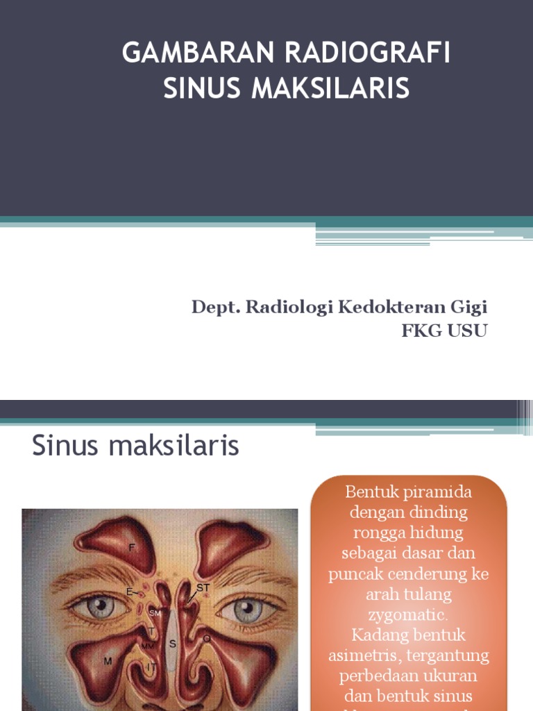 Radiografi Sinus Maksilaris: Anatomi & Sinusitis | PDF