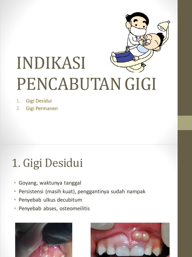 BM 3.4 Indikasi Pencabutan Gigi | PDF