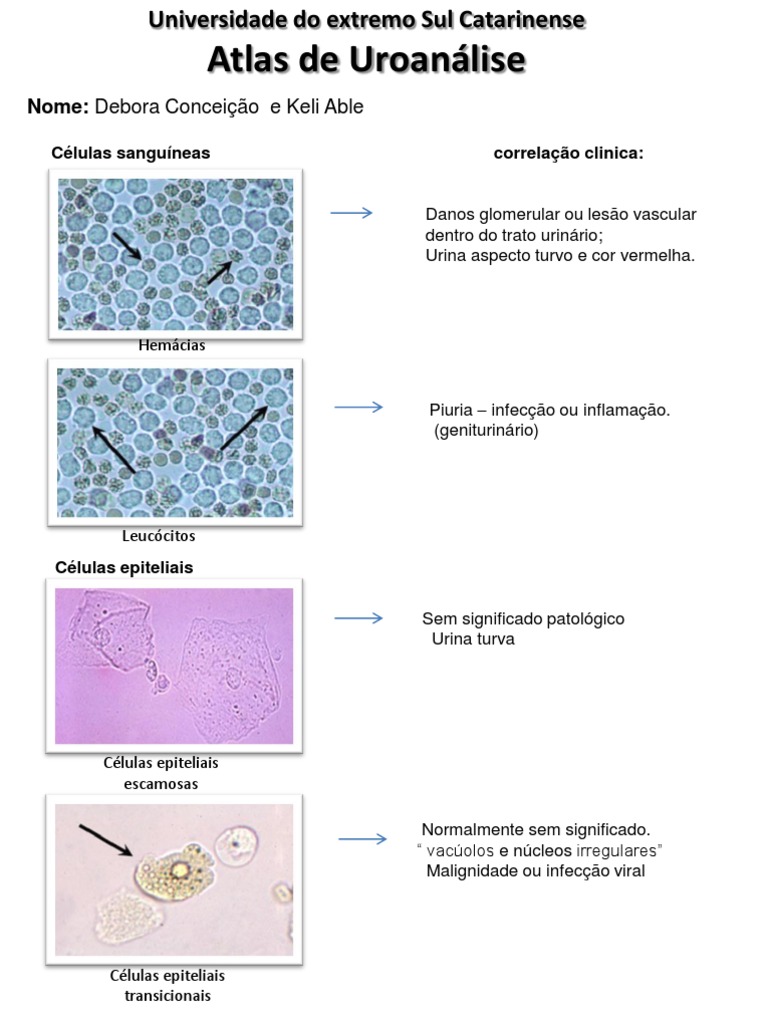 Atlas de Uroanálise: Guia ilustrado dos achados microscópicos na urina ...