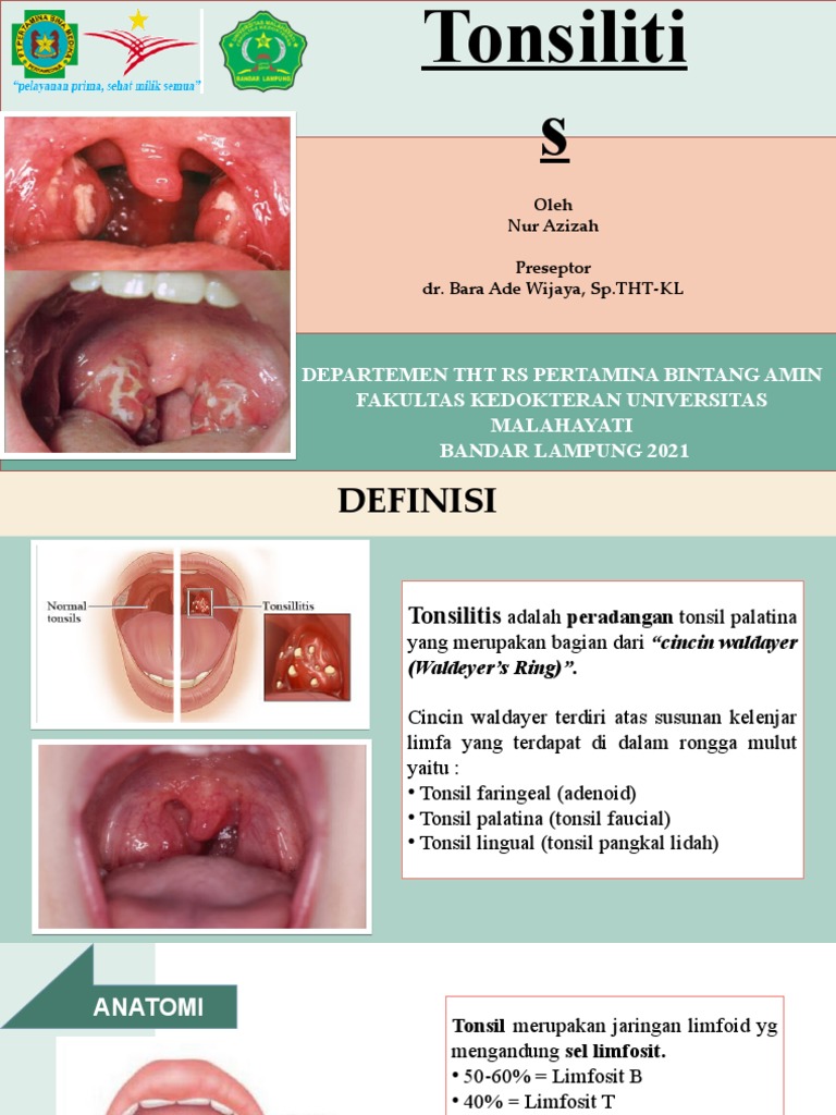 Tonsilitis | PDF