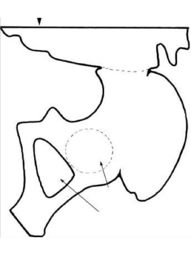Pelvis | PDF
