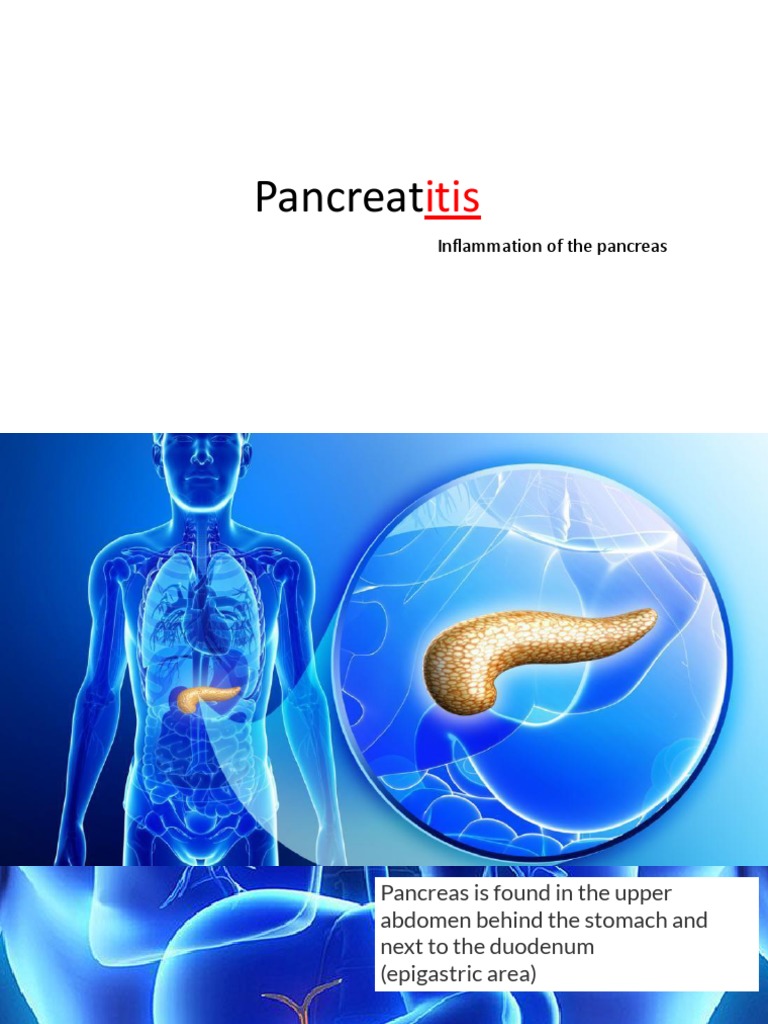 Overview of Pancreatitis Management | PDF | Pancreas | Diseases And ...