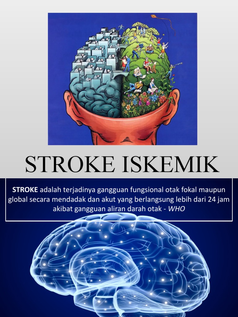 Stroke Iskemik PPT Ivon | PDF