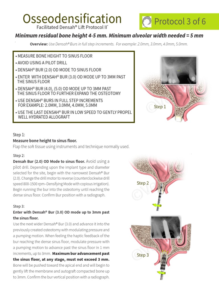 Osseodensification: Protocol 3 of 6 | PDF | Dental Implant | Dentistry
