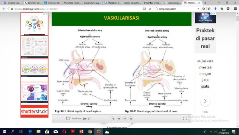 Vaskularisasi Cavum Nasi | PDF