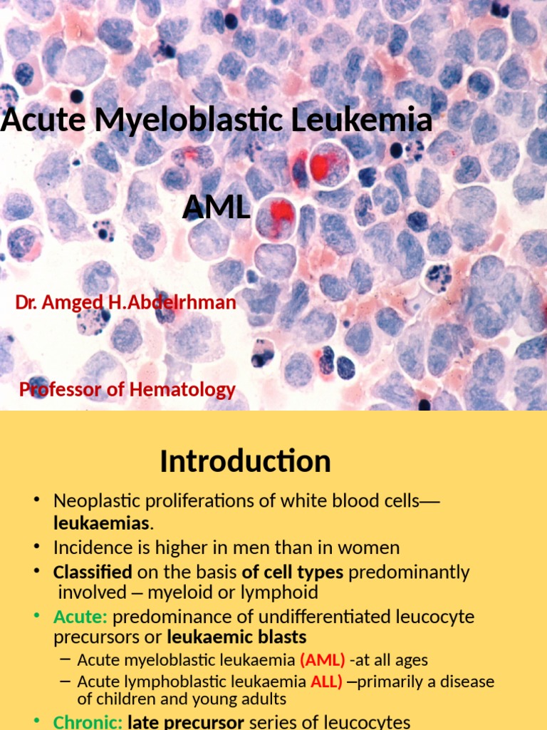 Acute Myeloblastic Leukemia: A Review of Classification, Clinical ...