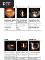 Tecnica de Van Herick | PDF | Córnea | Óptica