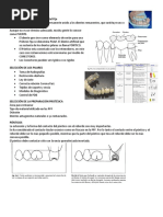 Tipos y funciones del póntico en prótesis fija | PDF | Dentadura ...