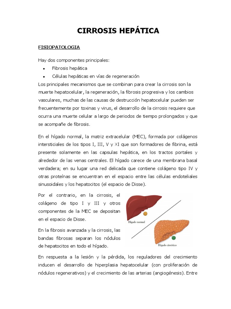 Cirrosis Hepática | PDF | Cirrosis | Especialidades Medicas