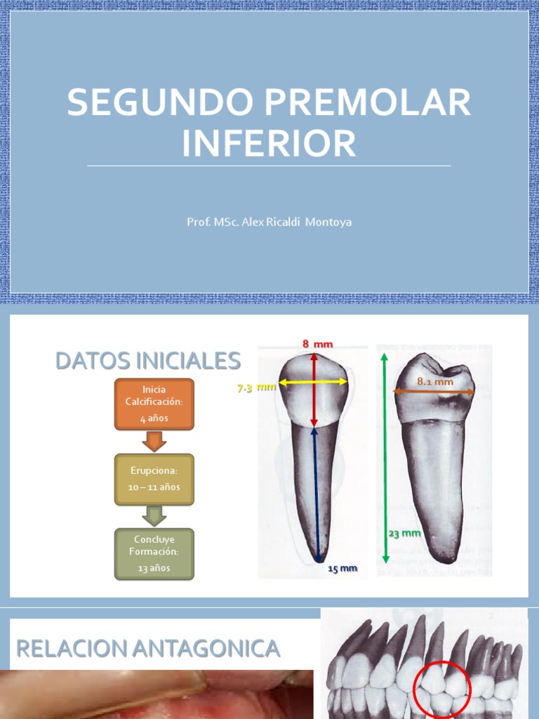 Anatomía del Segundo Premolar Inferior | PDF | Ramas de Odontología ...