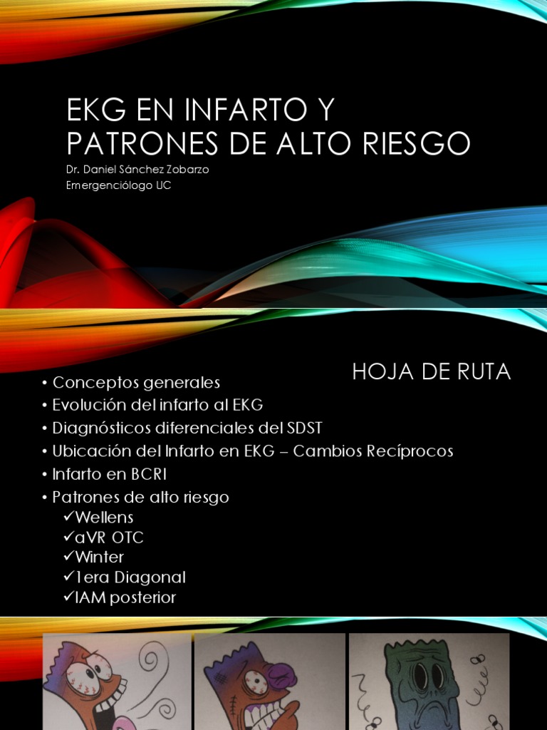 EKG en Infarto y Patrones de Alto Riesgo | PDF | Electrocardiografia | Especialidades Medicas