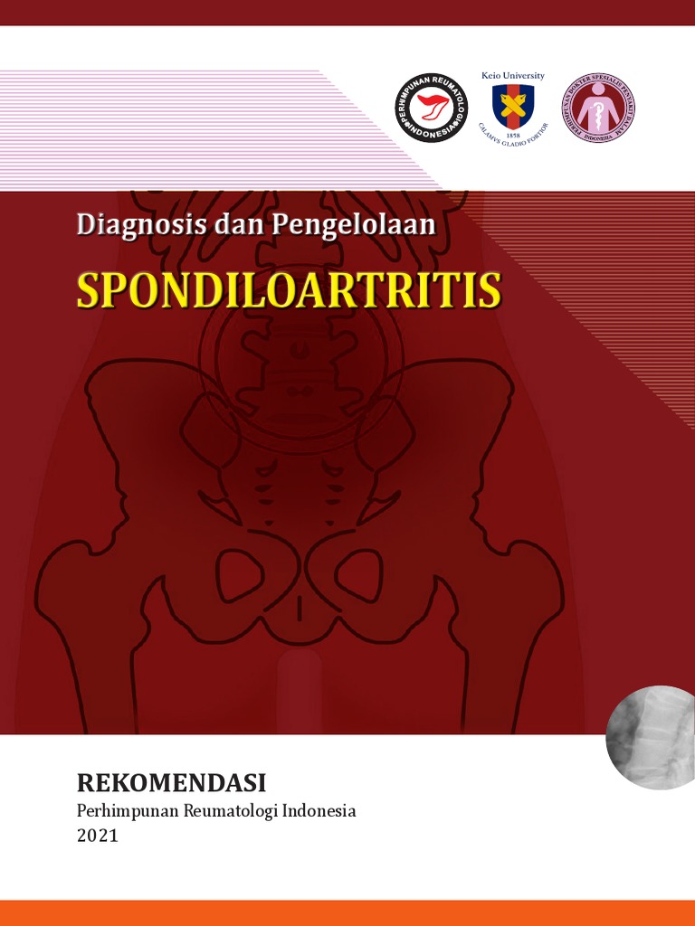 Rekomendasi Pengelolaan Spondiloartritis | PDF