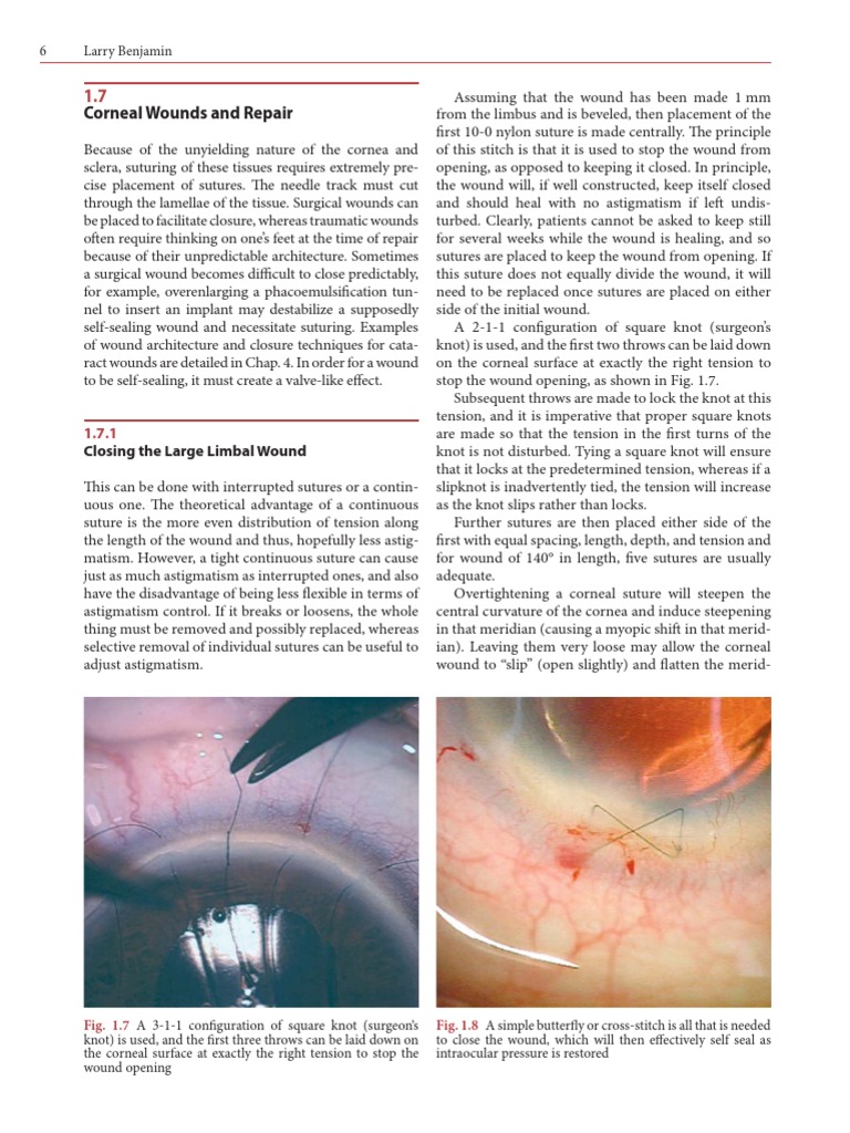 (123doc) Ophthalmic Microsurgical Suturing Techniques Part 2 | PDF ...