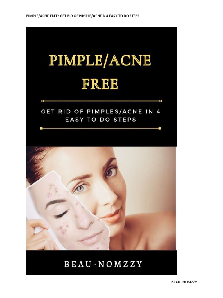Get Rid of Pimple in Four Easy Steps | PDF | Pimple | Skin