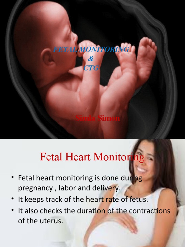 Fetal Monitoring | PDF