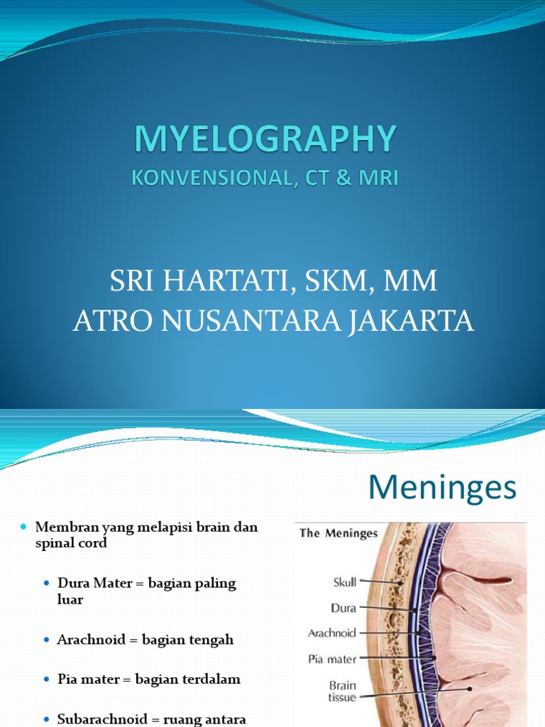 Prosedur dan Komplikasi Myelografi | PDF | Kesehatan Holistik | Sains ...