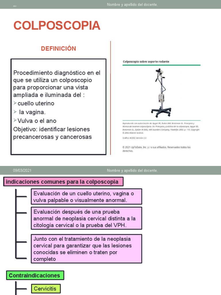 Guía Completa sobre Colposcopia | PDF | Salud pública | Ginecología