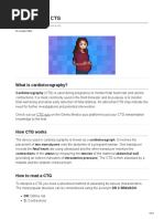 CTG Interpretation Fully Explained | PDF | Childbirth | Human Pregnancy