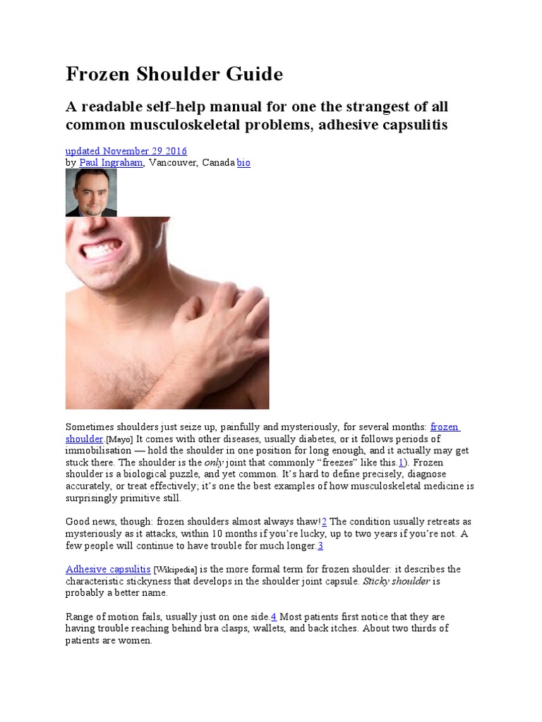 Frozen Shoulder Guide | PDF | Shoulder | Arthritis