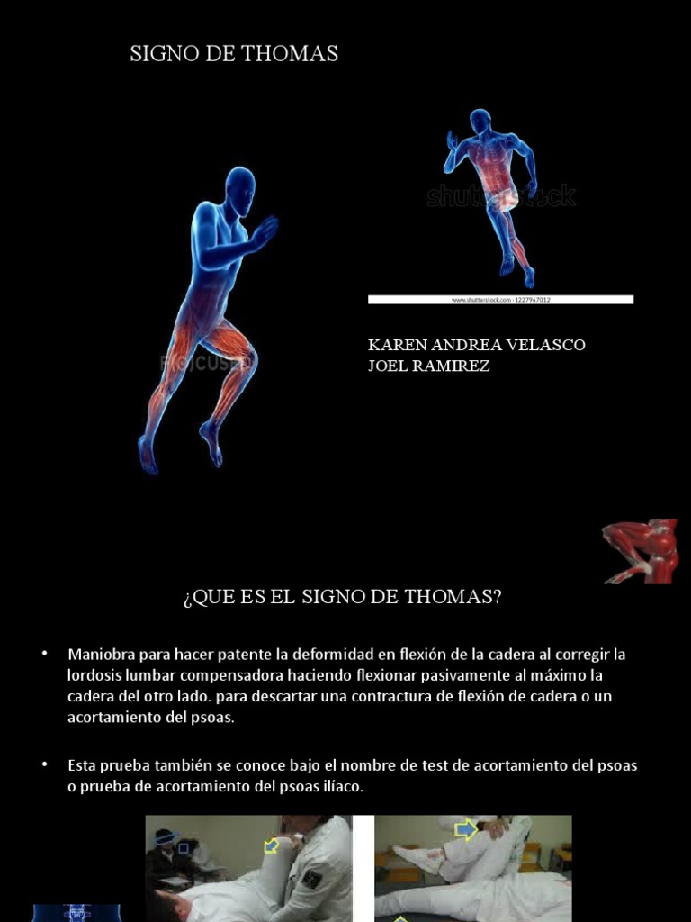 Signo de Thomas: Evaluación de Acortamientos | PDF | Rodilla | Anatomía ...