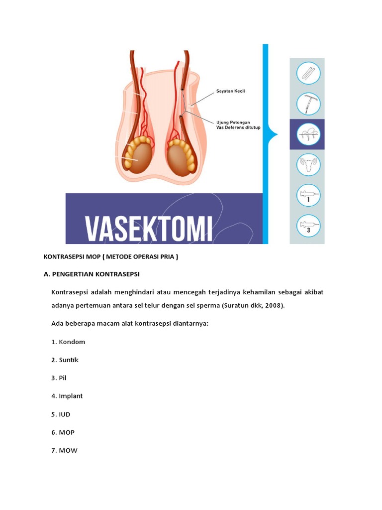 Metode Operasi Pria | PDF