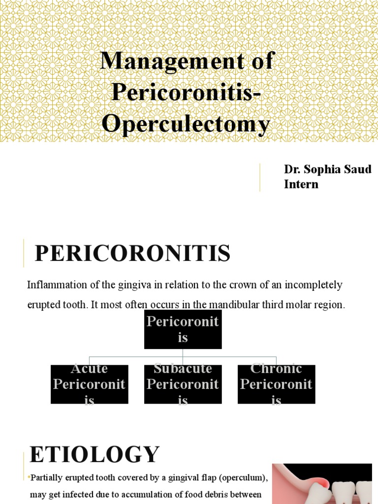Management of Pericoronitis with Laser Assisted Operculectomy | PDF ...