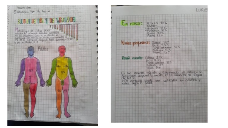 Regla de 9 Wallace | PDF