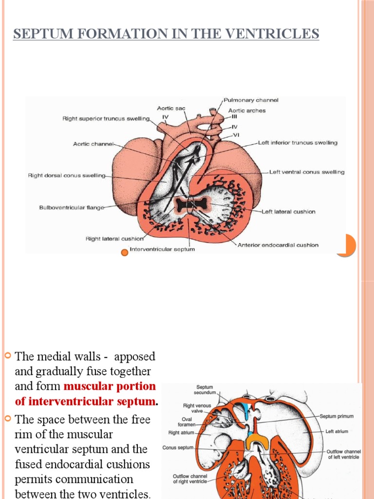 Ventricular Septum Formation Overview | PDF | Aorta | Congenital Heart ...