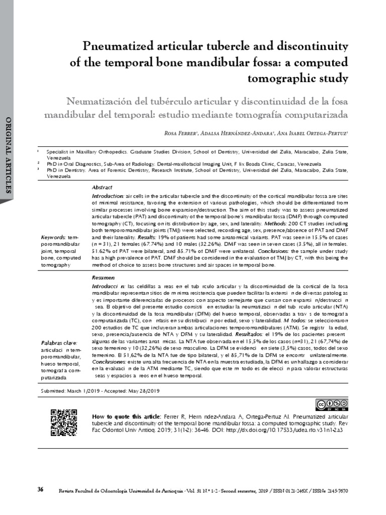 Pneumatized Articular Tubercle and Discontinuity of The Temporal Bone ...