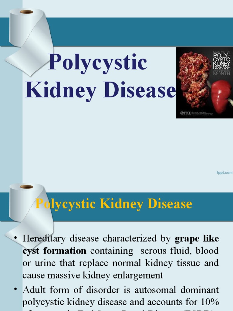 Overview of Polycystic Kidney Disease | PDF | Kidney | Medical Specialties