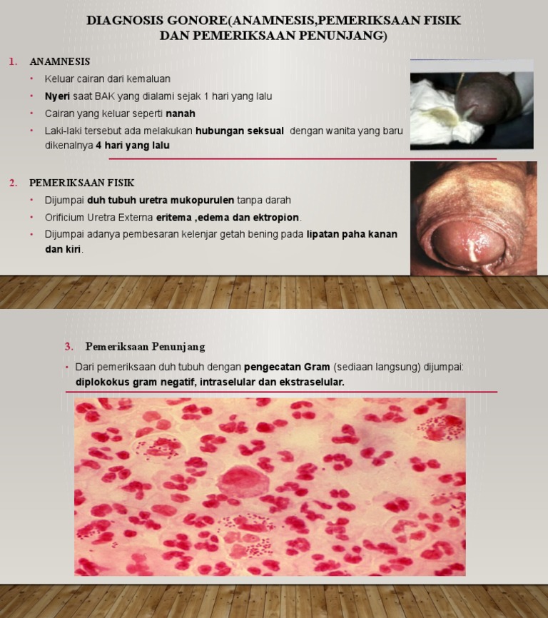Diagnosis Gonore (Anamnesis, Pemeriksaan Fisik Dan Penunjang) | PDF ...