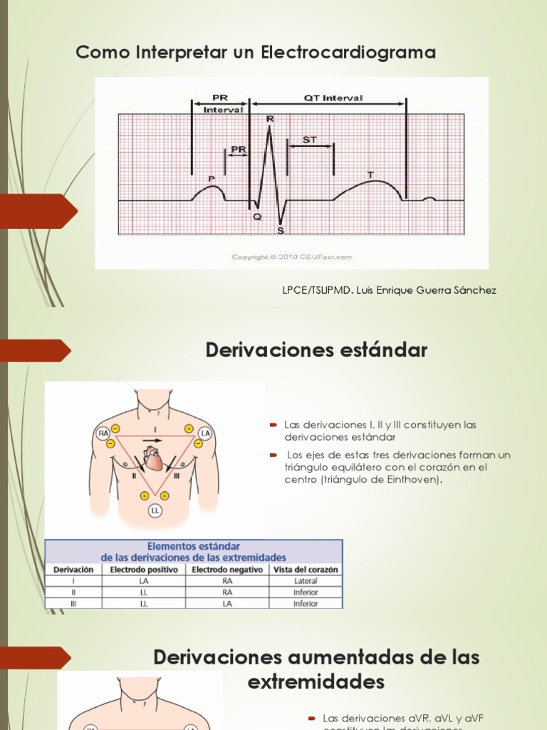 Como Interpretar Un Electrocardiograma | PDF | Electrocardiografia | Sistema cardiovascular