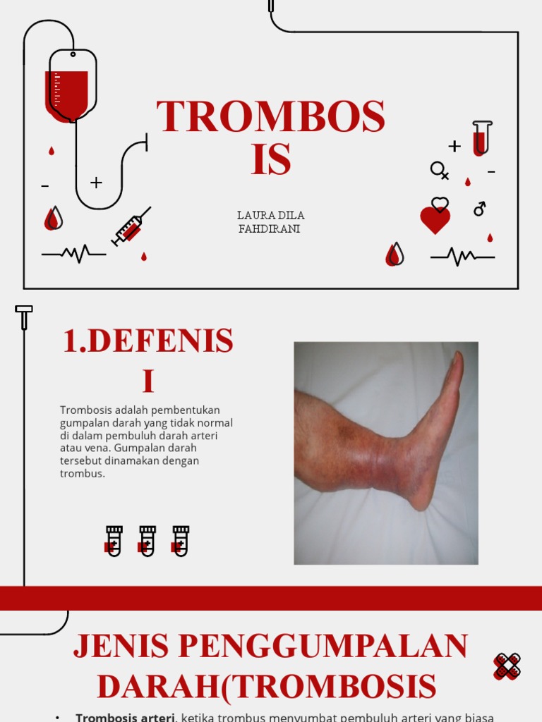 TROMBOSIS | PDF | Kesehatan Holistik