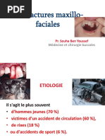 Fracture Du Rocher DR Amarache 2016 | PDF | vertige | Traumatisme crânien