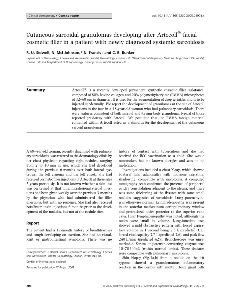 Cutaneous Sarcoidal Granulomas Developing After Artecoll Facial ...