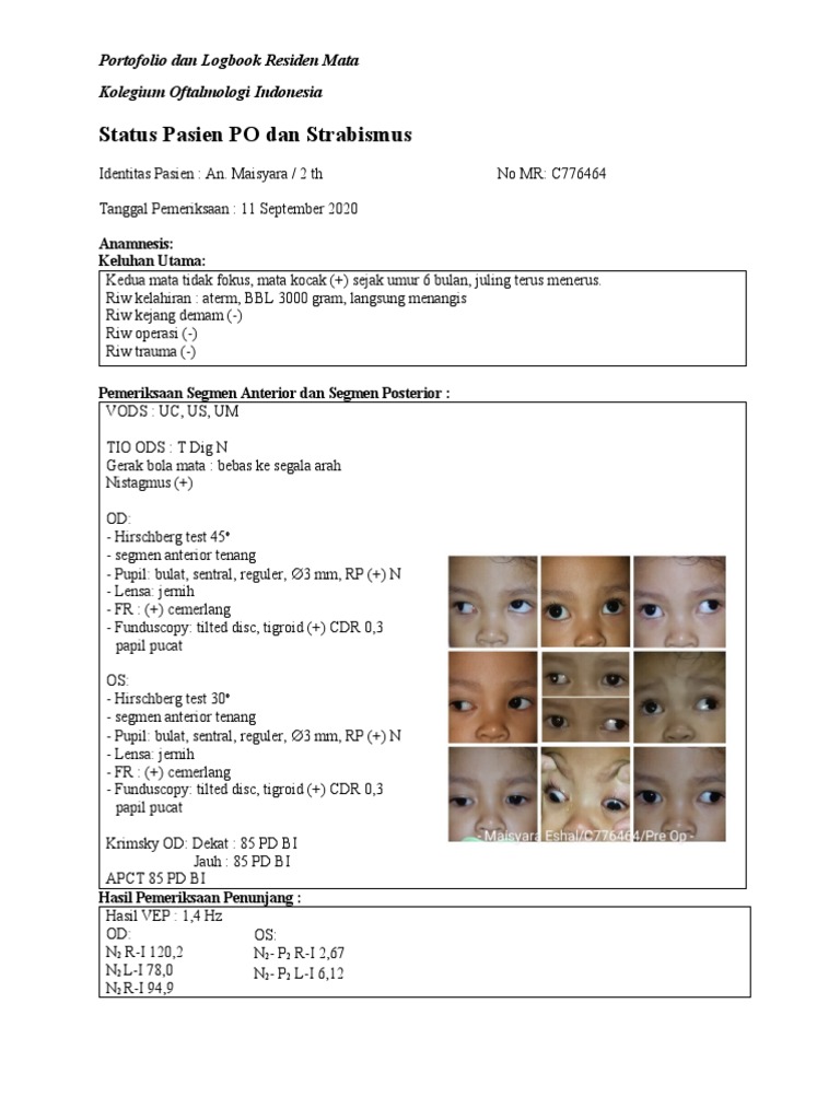 Logbook KOI Strabismus Sept-Okt 20 | PDF | Metode & Bahan Ajar