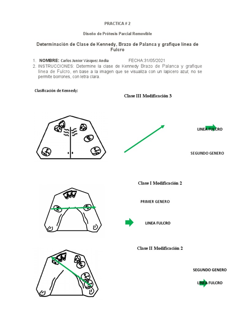 Línea de Fulcro en PPR Clase 2 | PDF