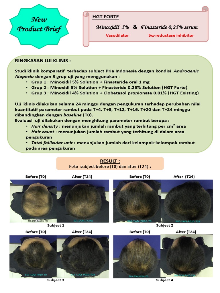 HGT Forte: Serum Minoxidil & Finasteride | PDF