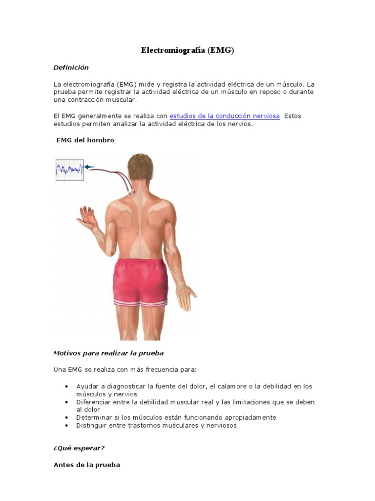 Electromiografía | Descargar gratis PDF | Electromiografia | Medicina CLINICA