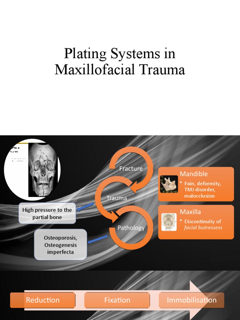 Plating Systems in Maxillofacial Trauma | PDF | Diseases And Disorders ...